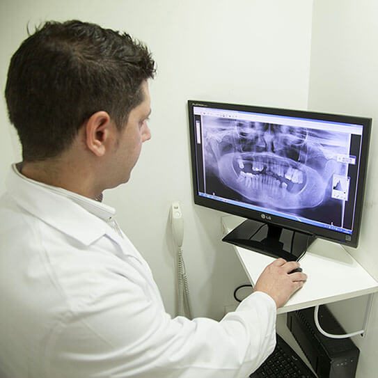 What Are All Those X-Rays For? - Bell Dental